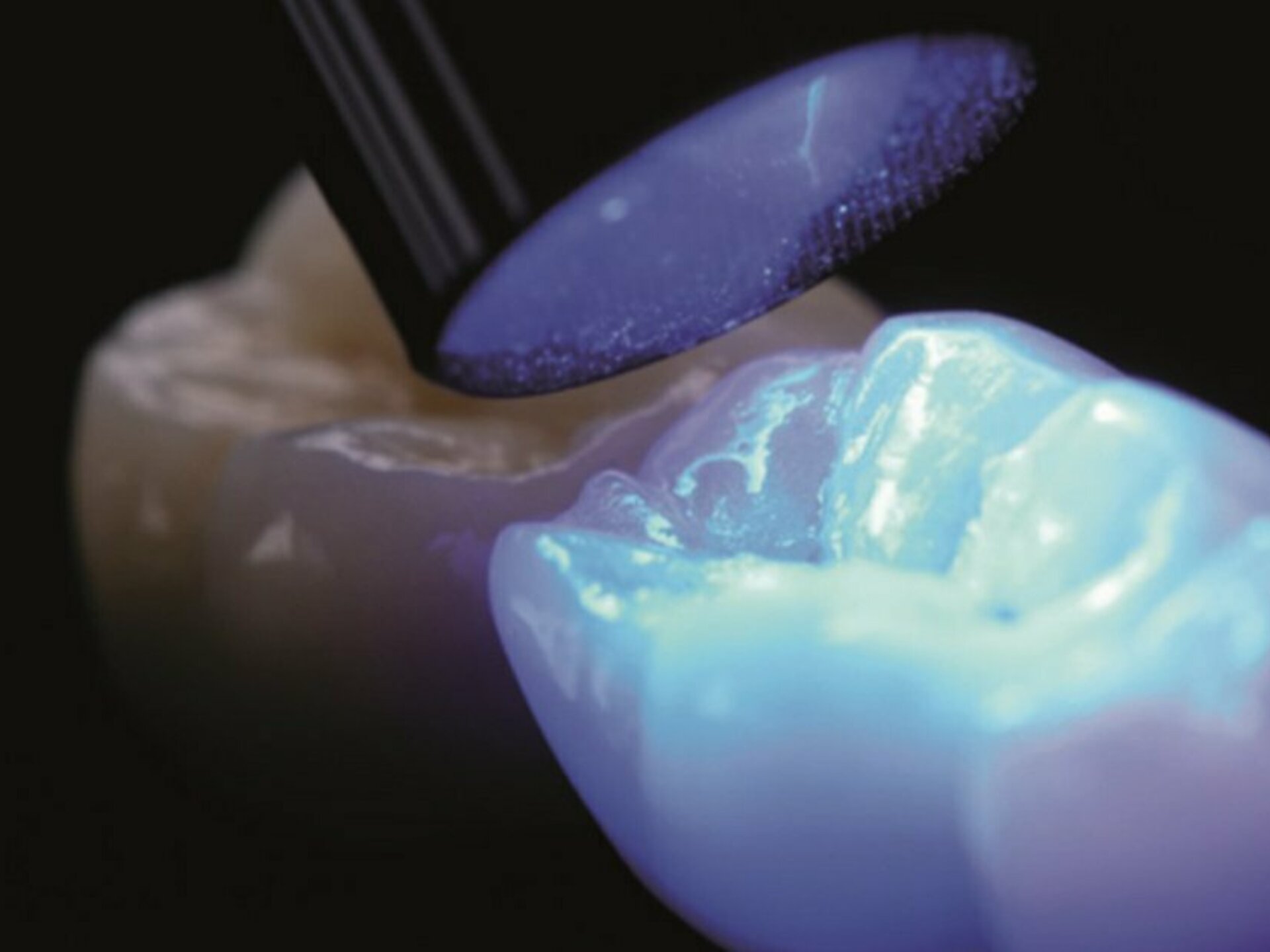 Expand your knowledge with the Direct Restorative Knowledge Hub : Ivoclar